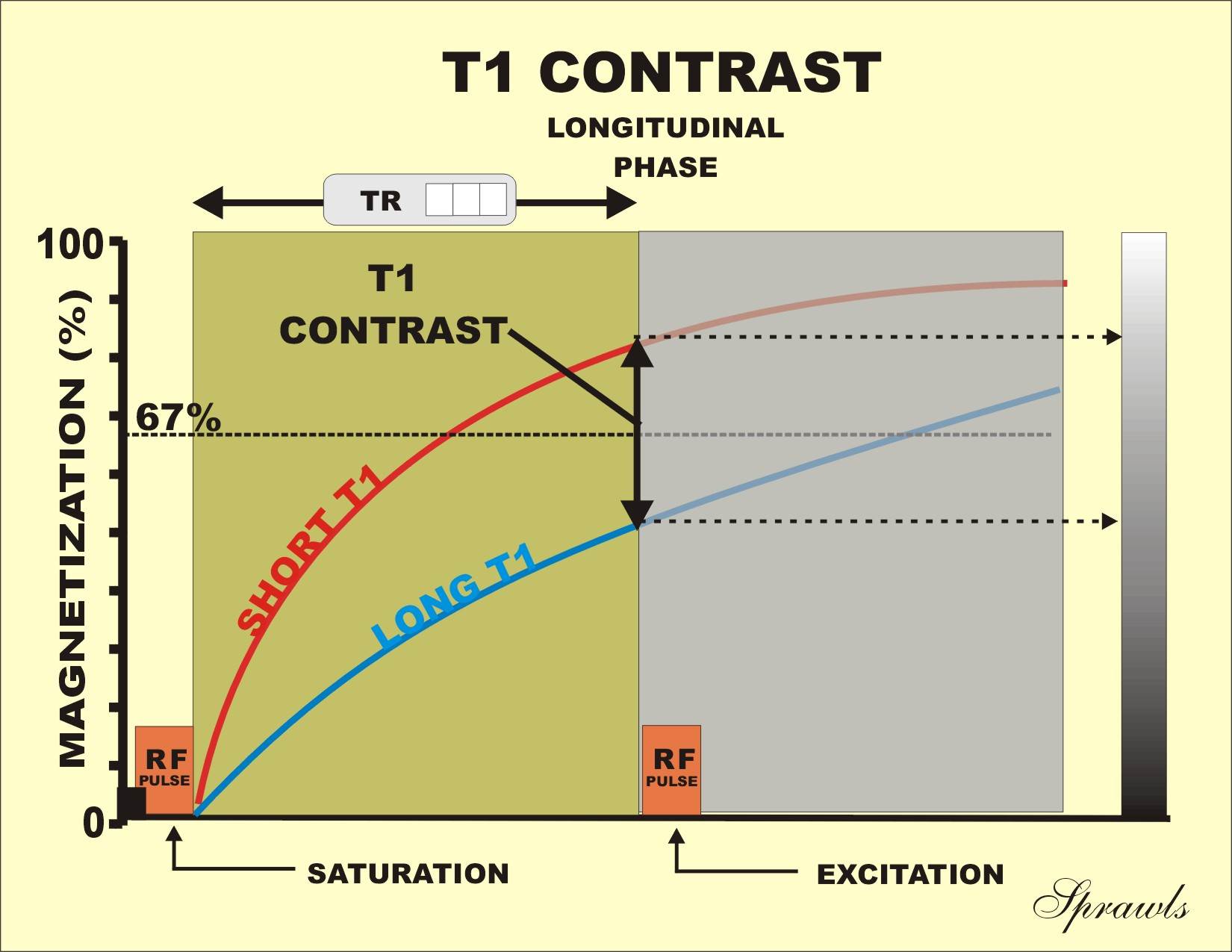 Magnetic Resonance Imaging